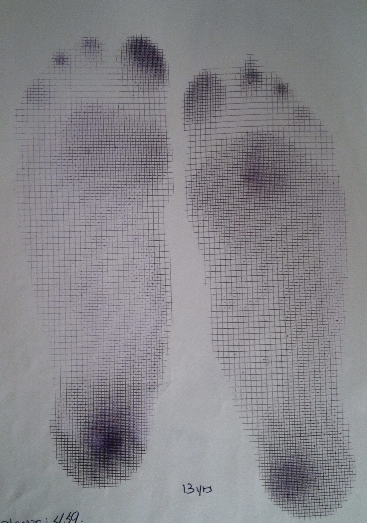 Foot Prints Analysis - Feet Balance Orthotics